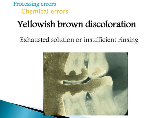 Errors of dental radiography | PPTX