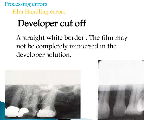 Errors of dental radiography | PPTX