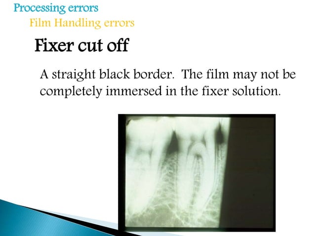 Errors of dental radiography | PPTX