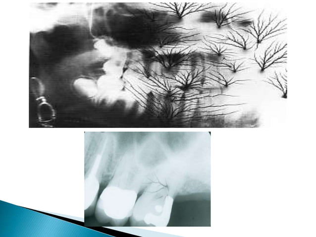 Errors of dental radiography | PPTX