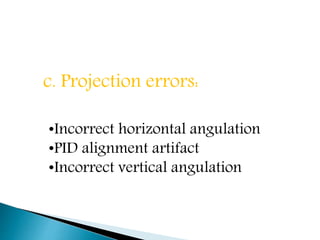 Errors of dental radiography | PPTX
