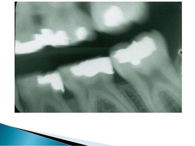 Errors of dental radiography