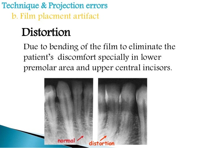 Errors of dental radiography