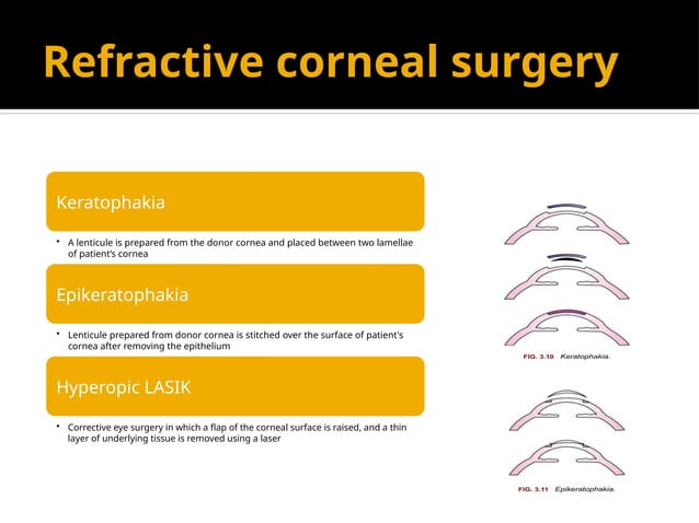 errorsofrefraction-gchgvtjycjtdddjj.pptx