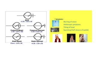 Errors of refraction | PPT