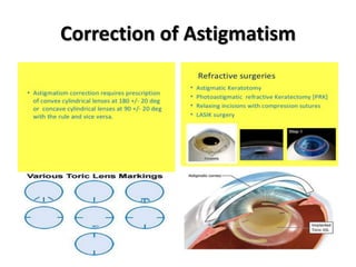 Errors of refraction | PPT