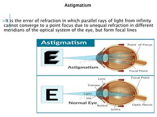 Errors of refraction | PPTX