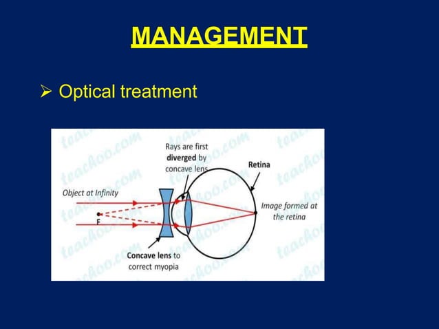 errorsofrefraction-200824062323.pptx