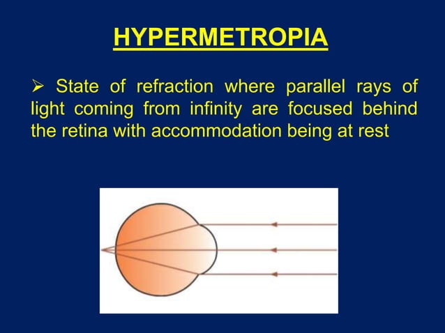 Errors of refraction | PPT | Eye and Vision Conditions | Diseases and ...