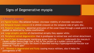 Errors of refraction | PPTX