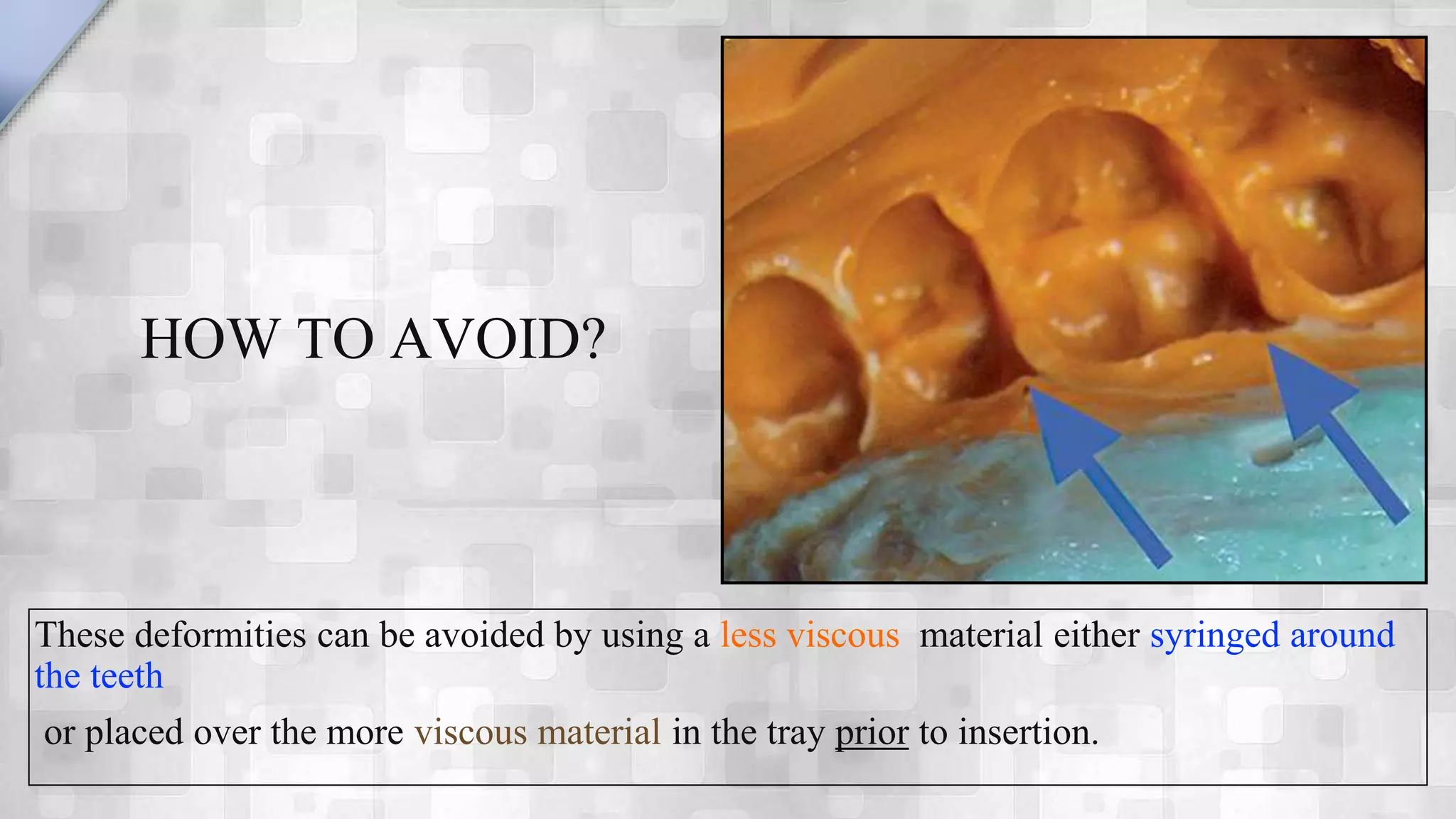 Errors In Impression Taking | PPSX