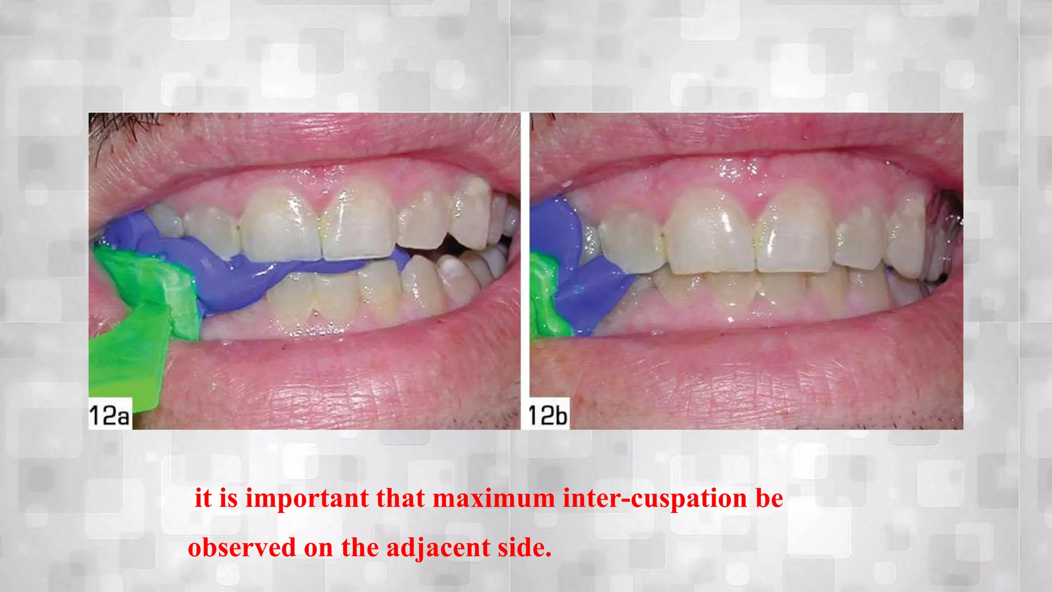 Errors In Impression Taking | PPSX