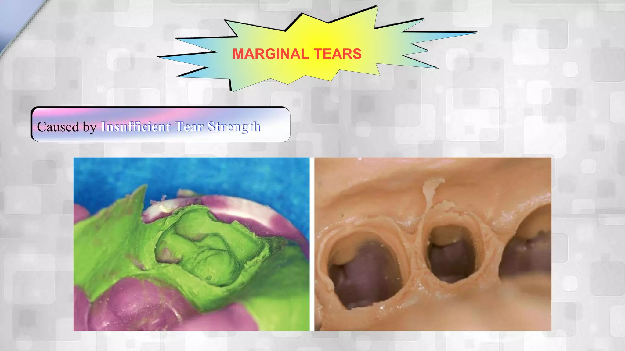 Errors In Impression Taking | PPSX