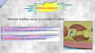 Errors In Impression Taking | PPSX