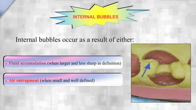 Errors In Impression Taking | PPSX