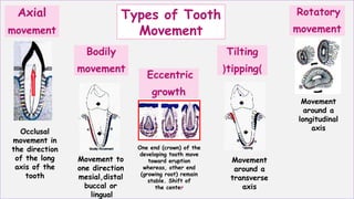 Erruption 2017 | PPT