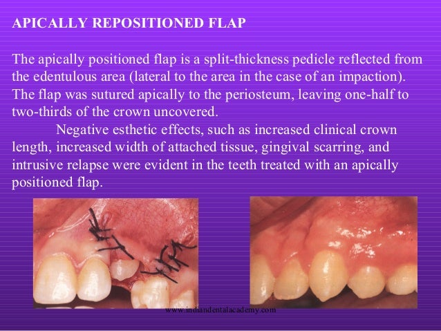 Eruptive abnormalities and their treatment