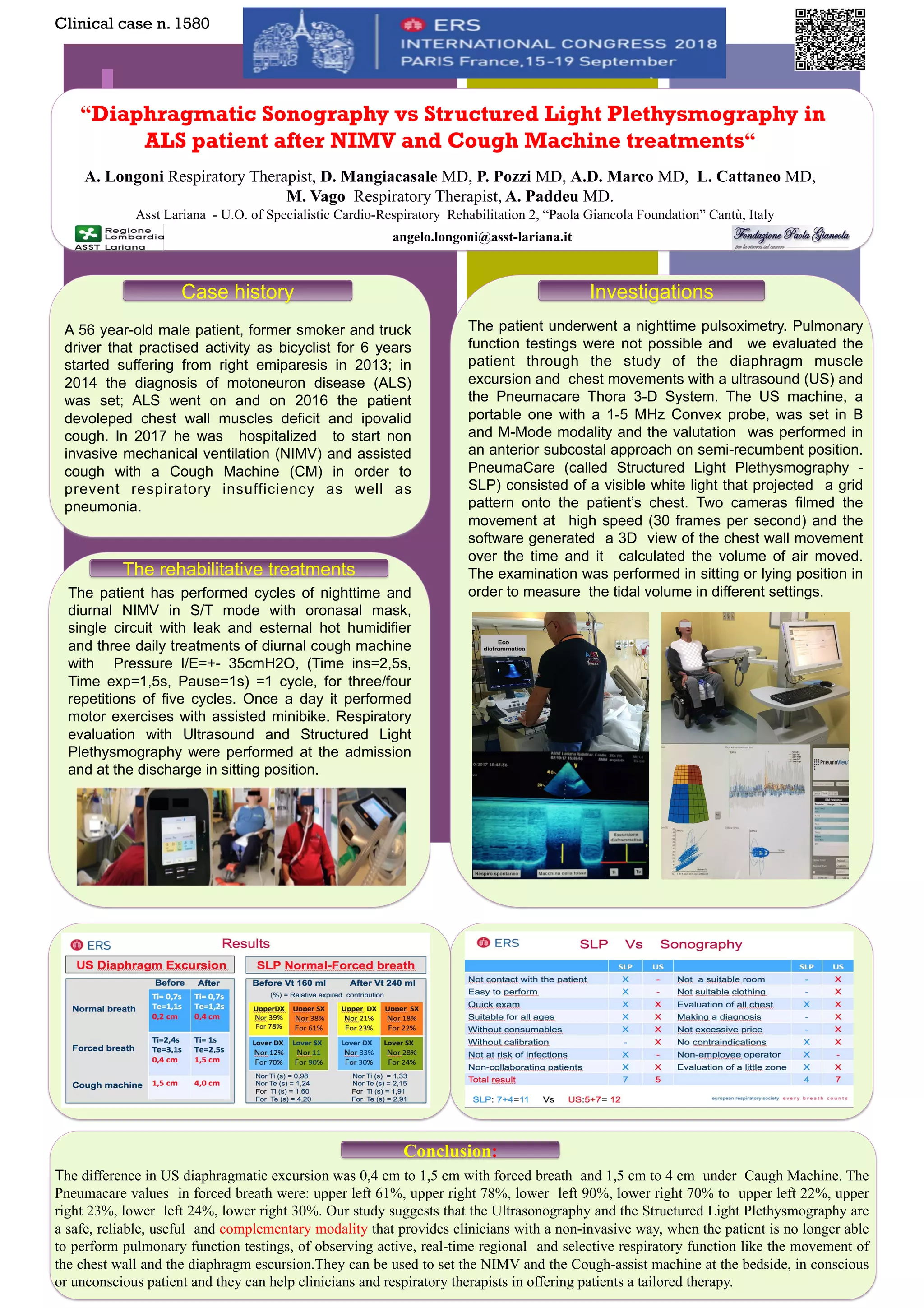 Diaphragmatic Sonography vs Structured Light Plethysmography in ALS ...