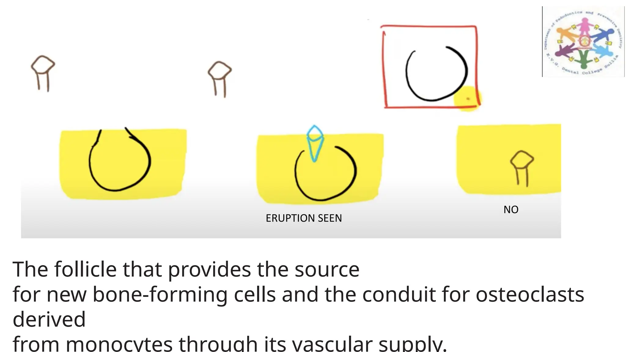 Eruption of tooth and theories of eruption in primary tooth | PPTX