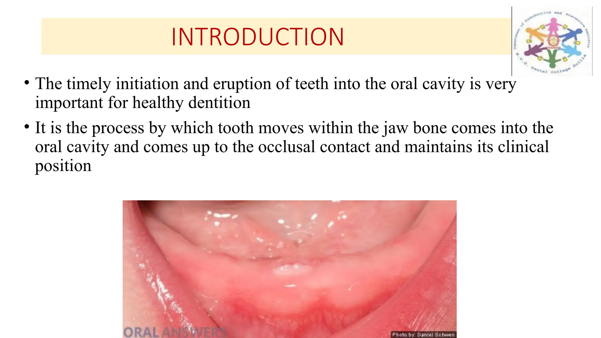 Eruption of tooth and theories of eruption in primary tooth | PPTX
