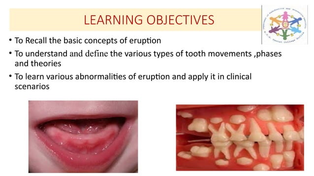 Eruption of tooth and theories of eruption in primary tooth | PPTX ...