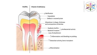 Eruption of tooth and theories of eruption in primary tooth | PPTX