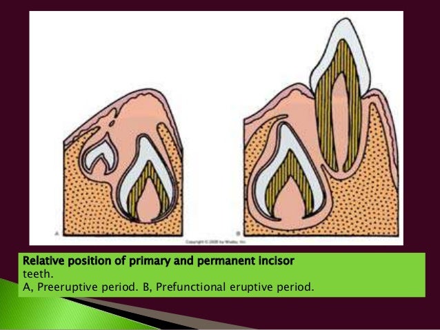 Eruption of teeth ( Hesham Dameer )