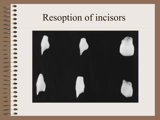 The eruption and shadding of the teeth .ppt