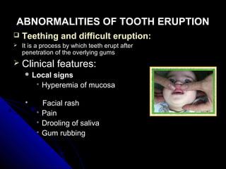 Eruption and shedding of teeth | PPT