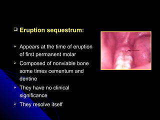 Eruption and shedding of teeth | PPT