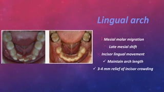 Eruption guidance of the developing dentition.pptx | Dental Health ...