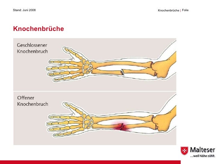 Erweiterte erste hilfe 2008