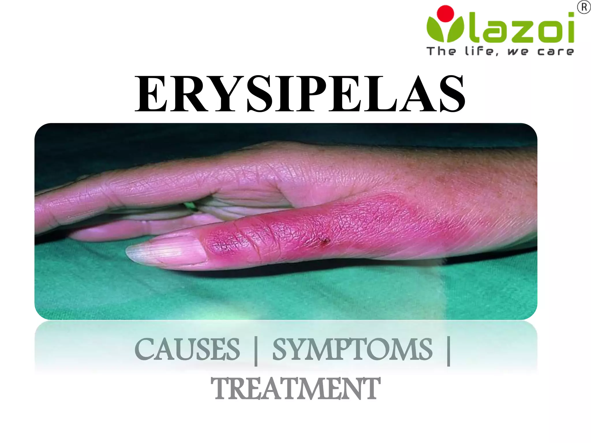 Erysipelas : causes, symptoms, diagnosis, prevention and treatments | PPTX