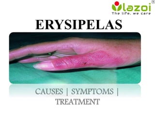 Erysipelas : causes, symptoms, diagnosis, prevention and treatments | PPTX