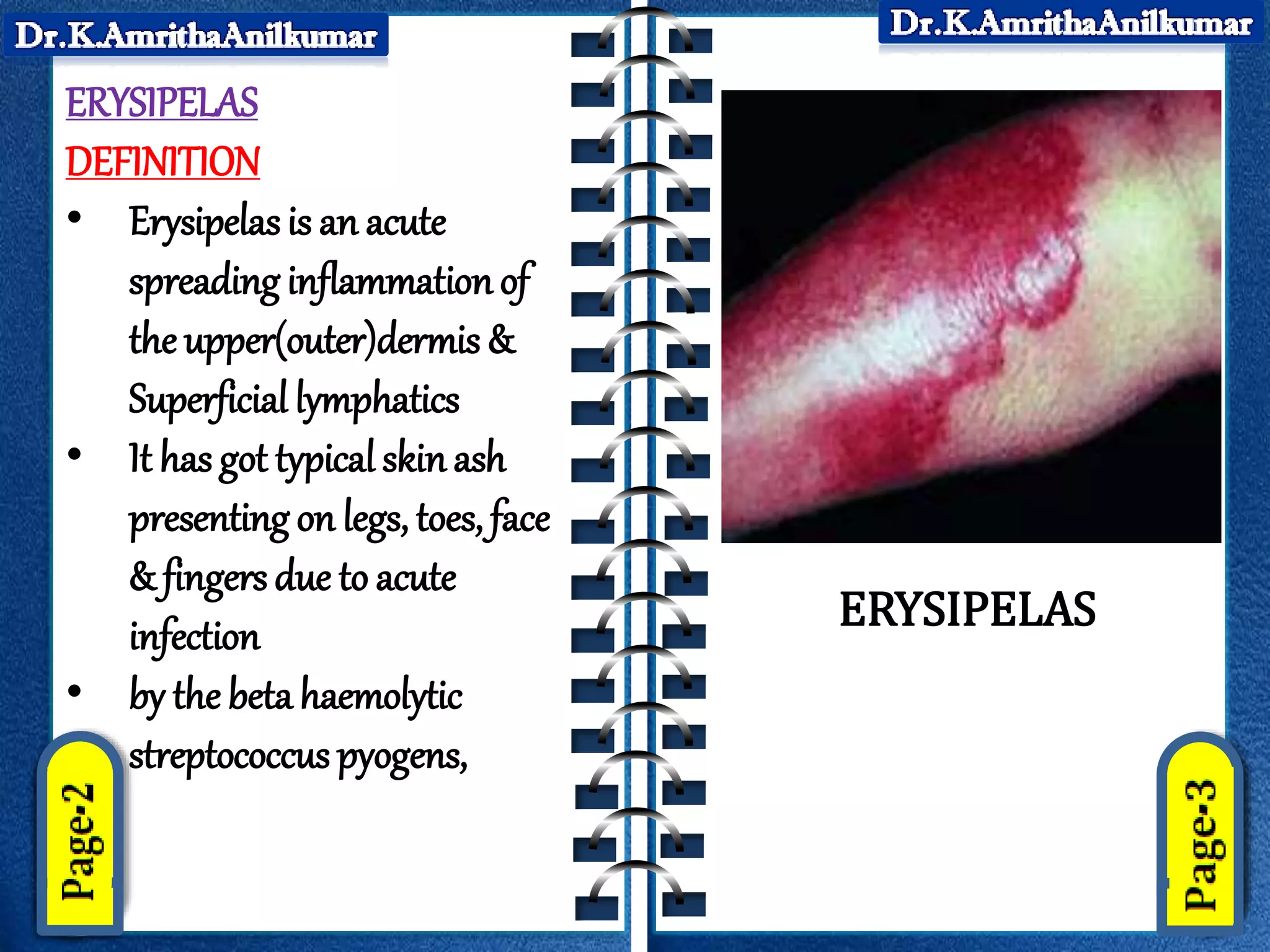 Erysipelas by Dr.K.AmrithaAnilkumar | PPTX