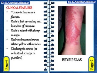 Erysipelas by Dr.K.AmrithaAnilkumar | PPTX