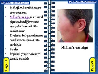 Erysipelas by Dr.K.AmrithaAnilkumar | PPTX