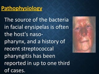 ERYSIPELAS.pptx