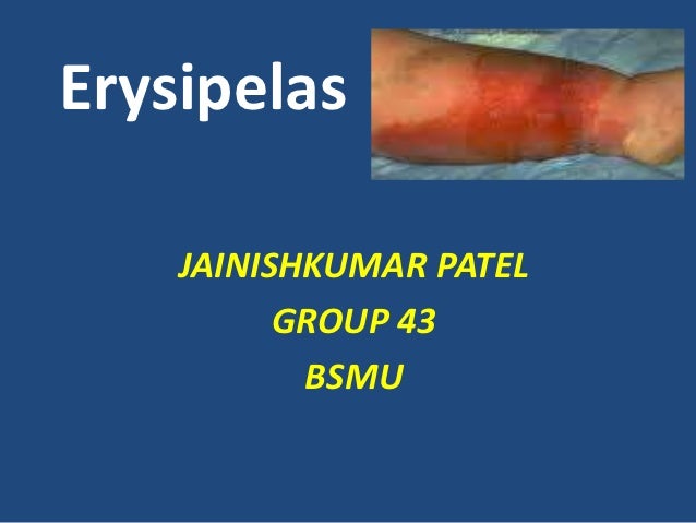 Erysipelas jainish patel Erysipelas jainish patel