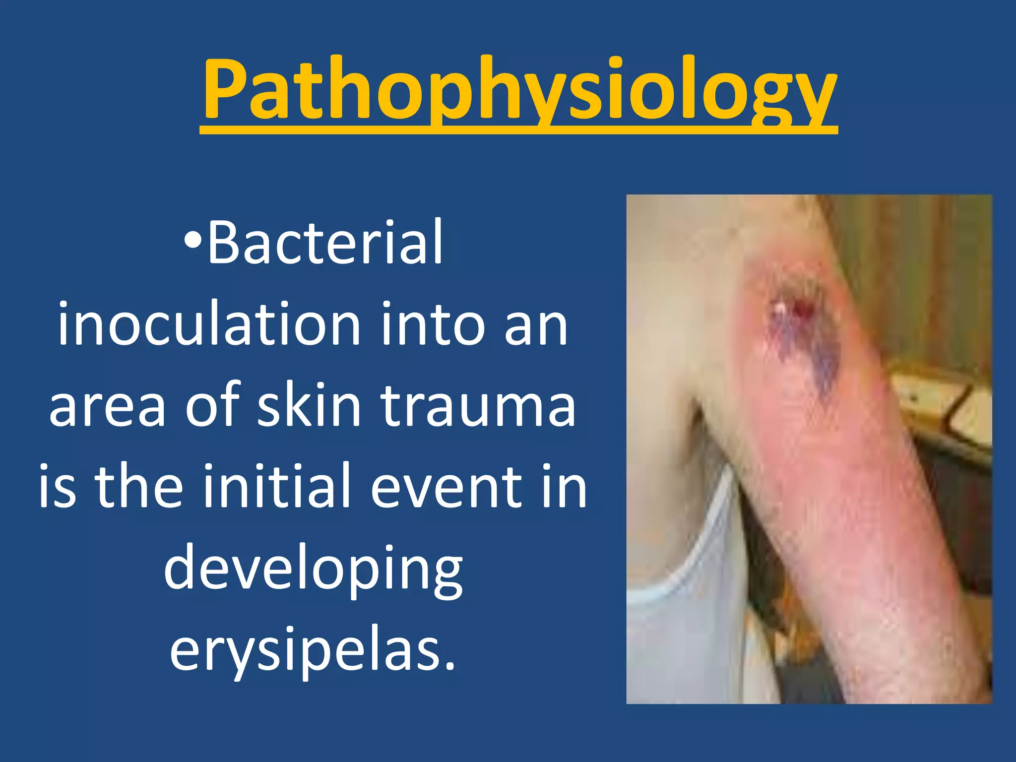Erysipelas | PPTX