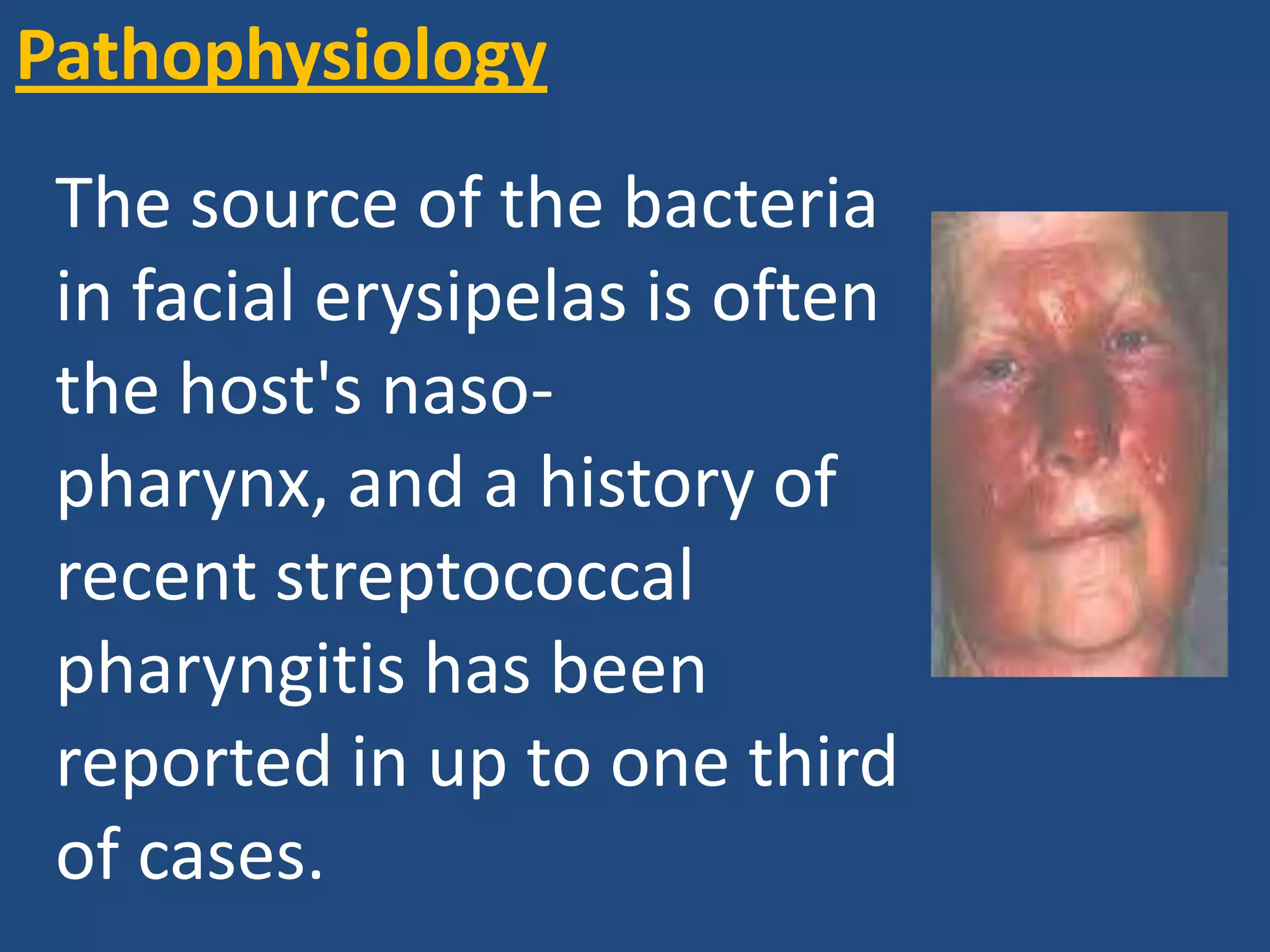 Erysipelas | PPTX