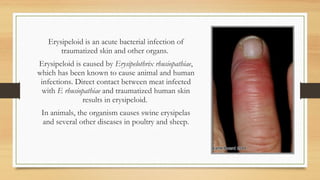 Erysipeloid | PPT