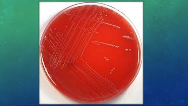 Erysipelothrix rhusiopathiae (ERISIPELA PORCINA)