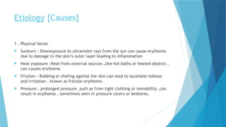all about know what is these Erythema.pptx