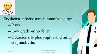 Erythema infectiosum (fifth disease) | PPT