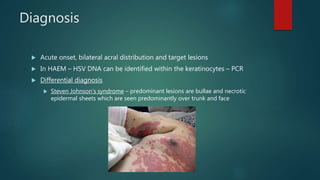 Erythema multiforme | PPTX