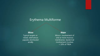 Erythema multiforme | PPTX