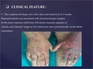 ERYTHEMA MULTIFORME.pptx