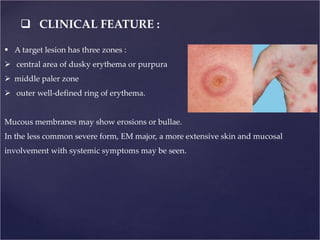 ERYTHEMA MULTIFORME.pptx