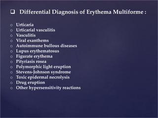 ERYTHEMA MULTIFORME.pptx